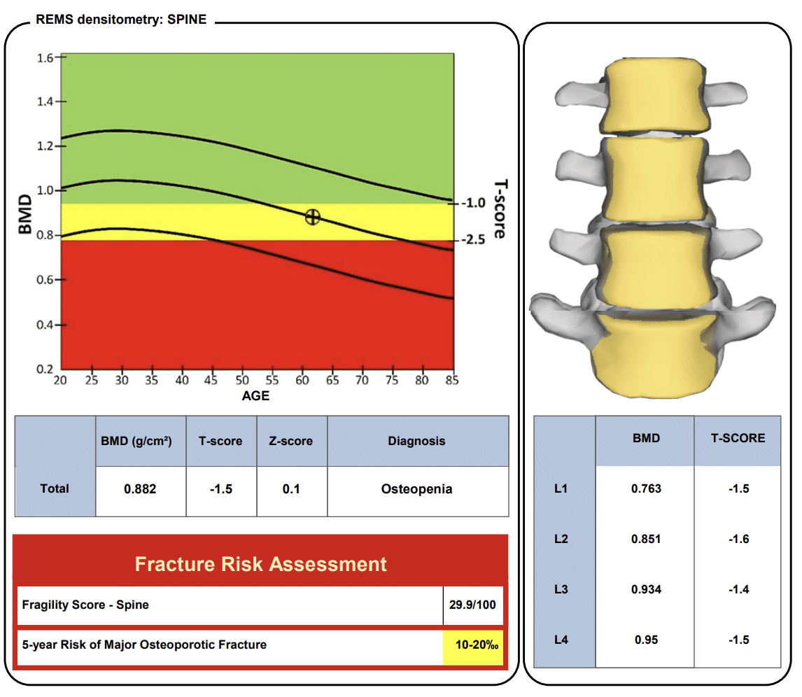 Endocrinologie cu bilet de trimitere - Osteodensys